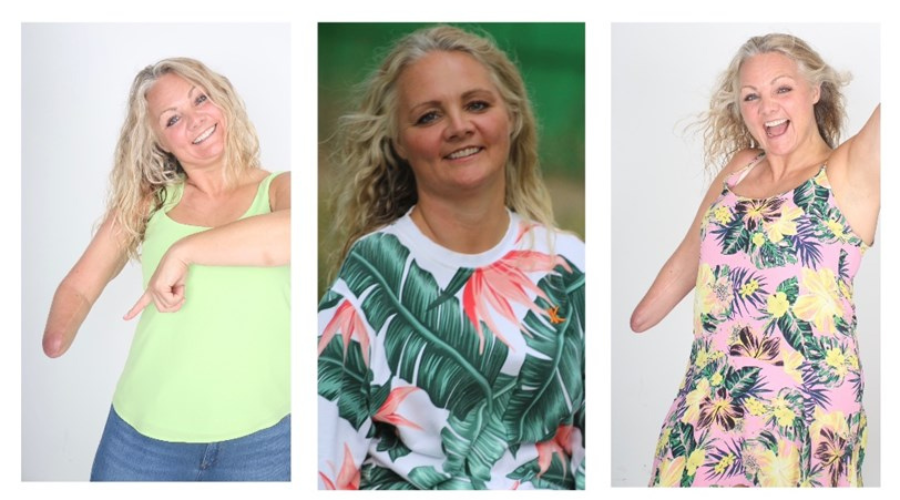 Fundraiser launched to help tour op Nicky get a bionic hand - Travel Gossip